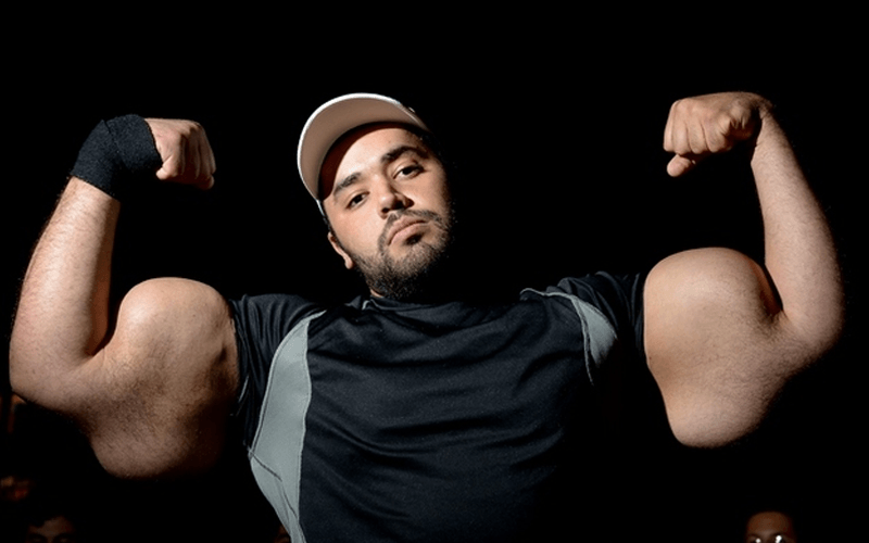 The Latest Synthol Freakshow Sweeping the Internet