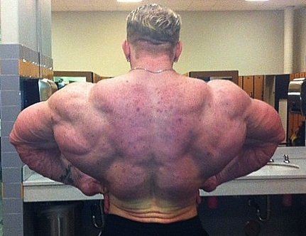 6 Easy Ways to Recognize a Steroid User